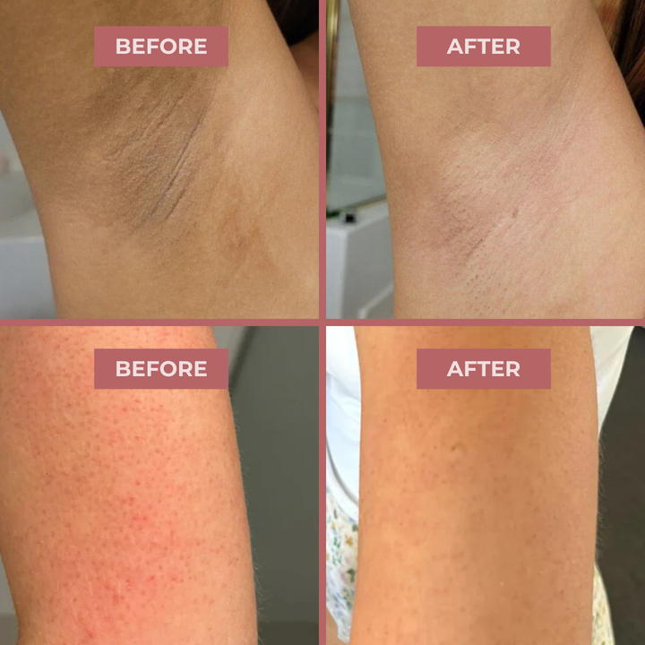 Dr. Melaxin Lichaamspeeling Spray – Heroka